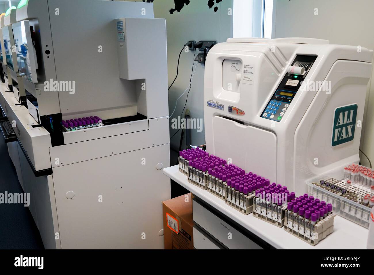 Blood Lab Test Sedimentation Rate at Dorothy Torrey blog