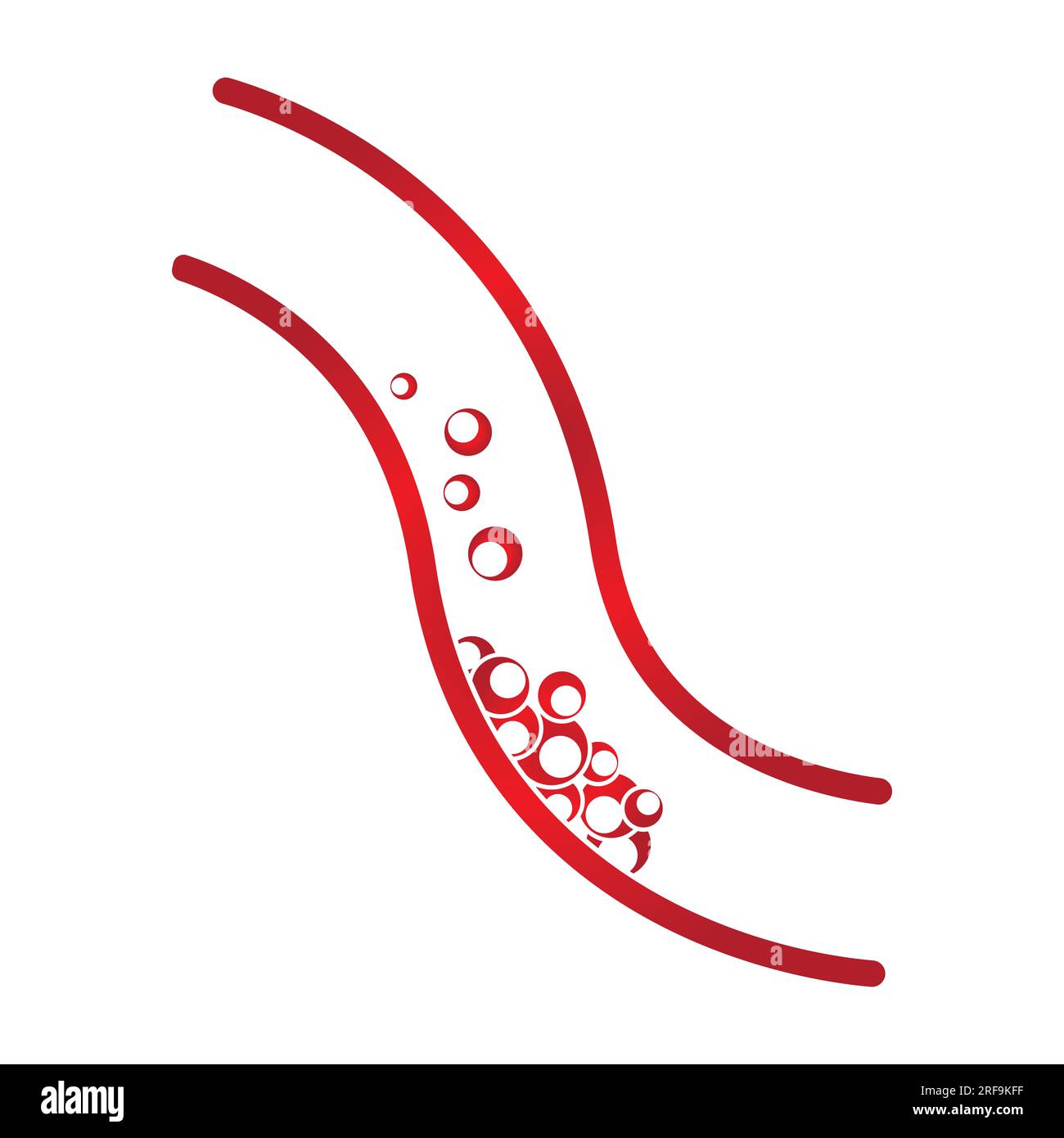 vector of cholesterol plaque illustratrion design Stock Photo - Alamy