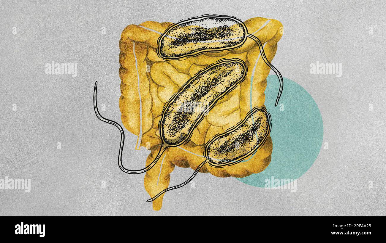 Illustration about the rise of Cholera cases. (Illustration/Amelia ...