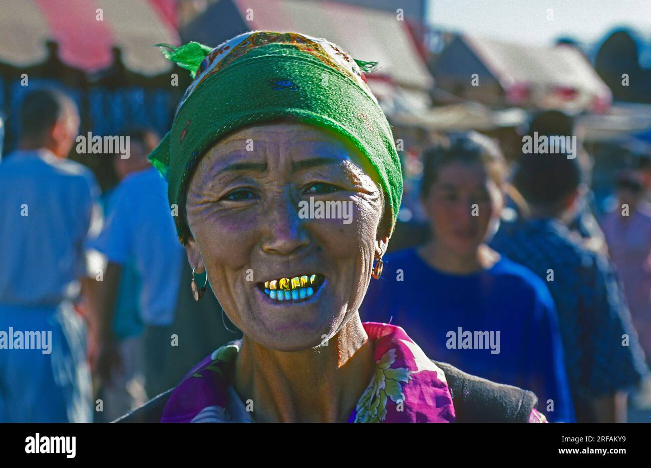 Gold teeth hi-res stock photography and images - Alamy