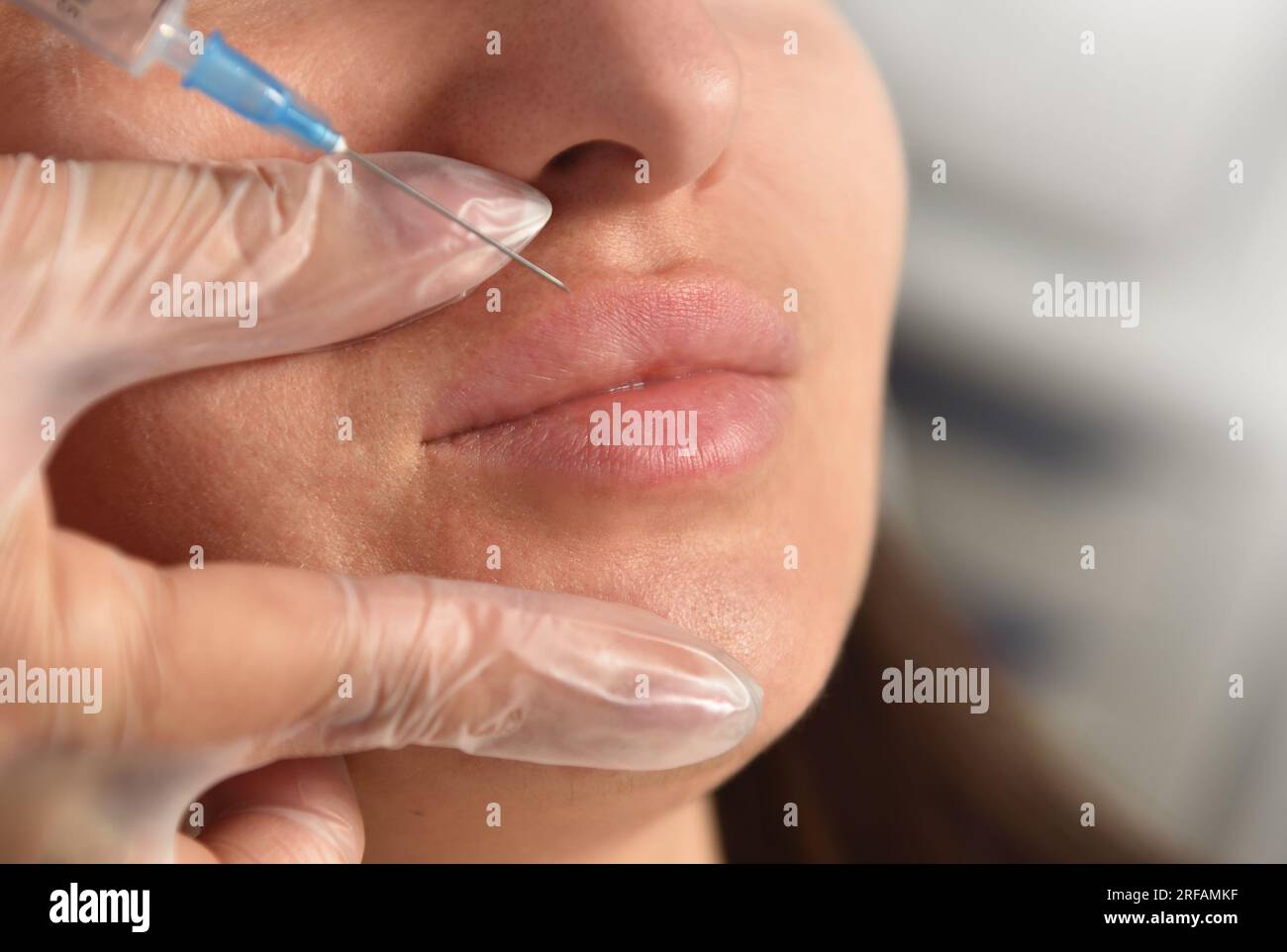 Injection procedure lip augmentation close hi-res stock photography and ...