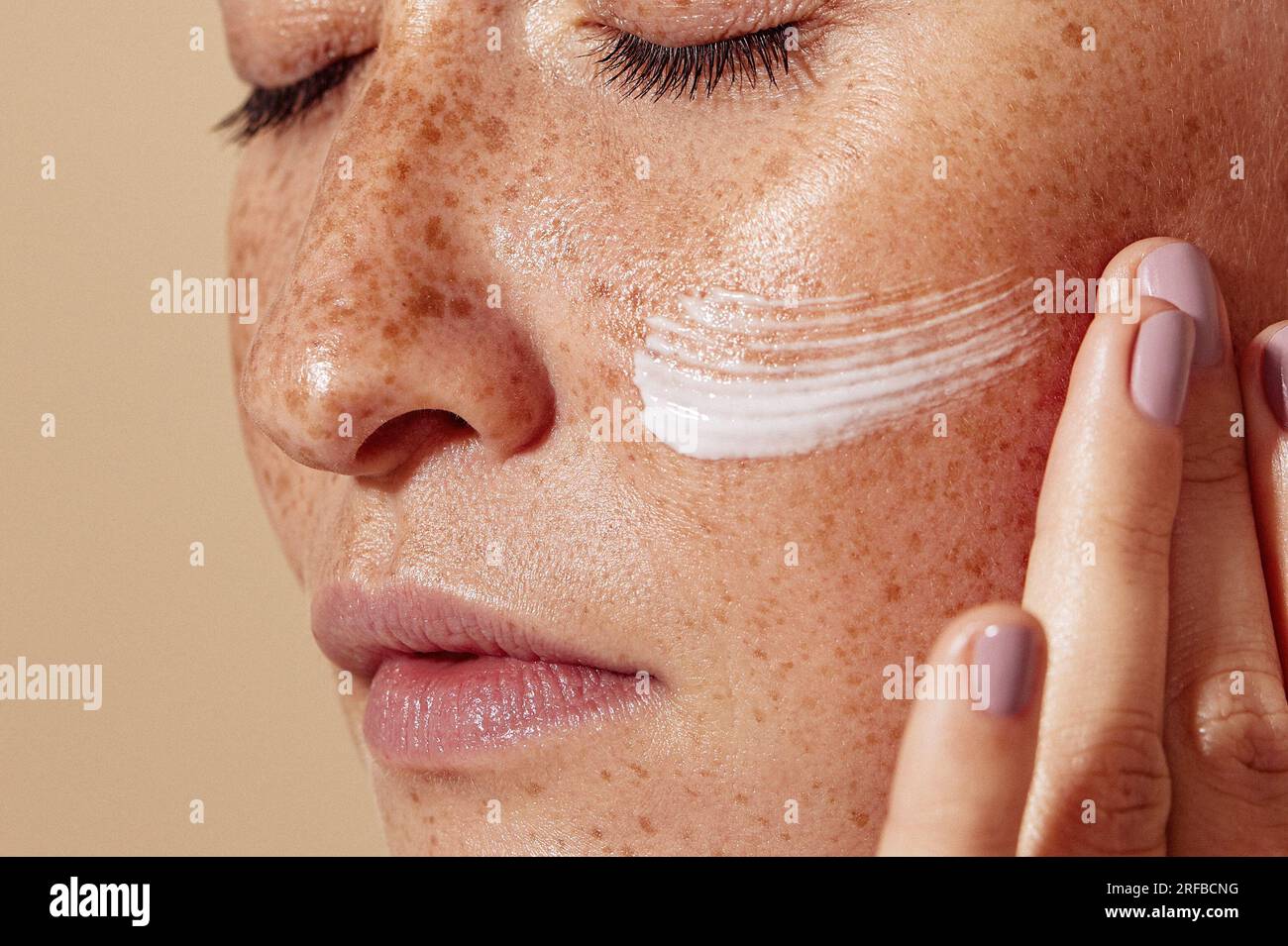Close-up of female face with freckled skin. High-detailed shot of woman ...