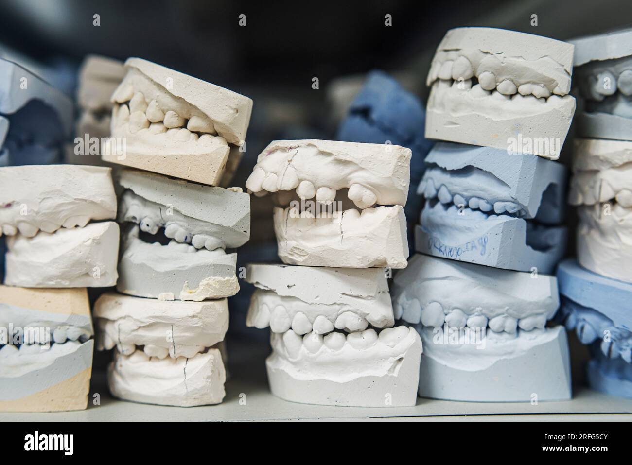 Place of storage of plaster models of human jaws in an orthodontic ...