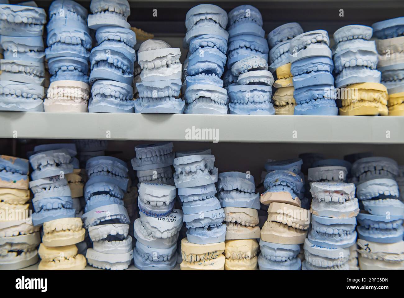 Place of storage of plaster models of human jaws in an orthodontic ...