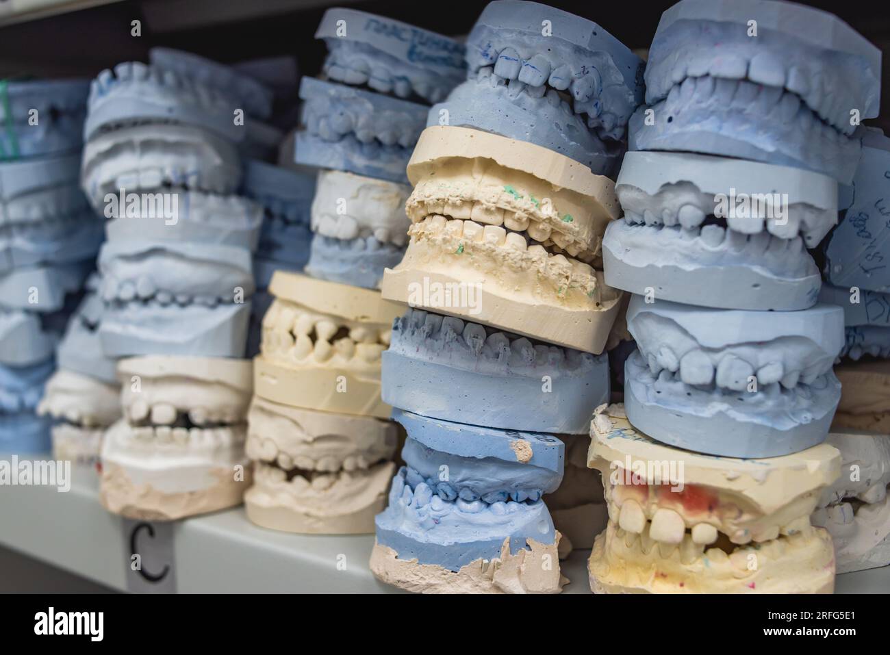 Place of storage of plaster models of human jaws in an orthodontic ...