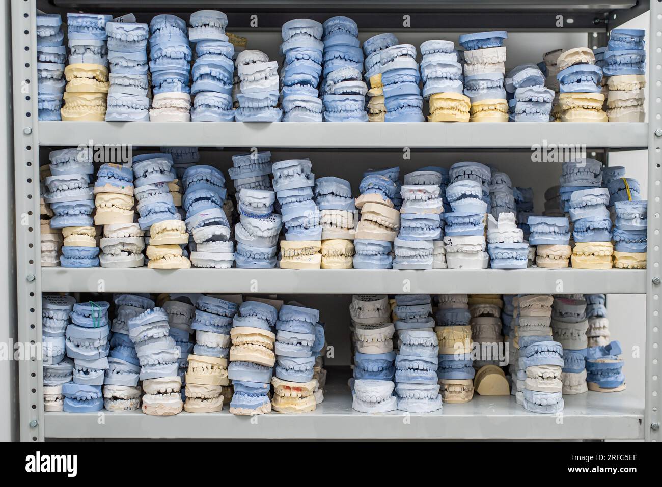 Place of storage of plaster models of human jaws in an orthodontic ...