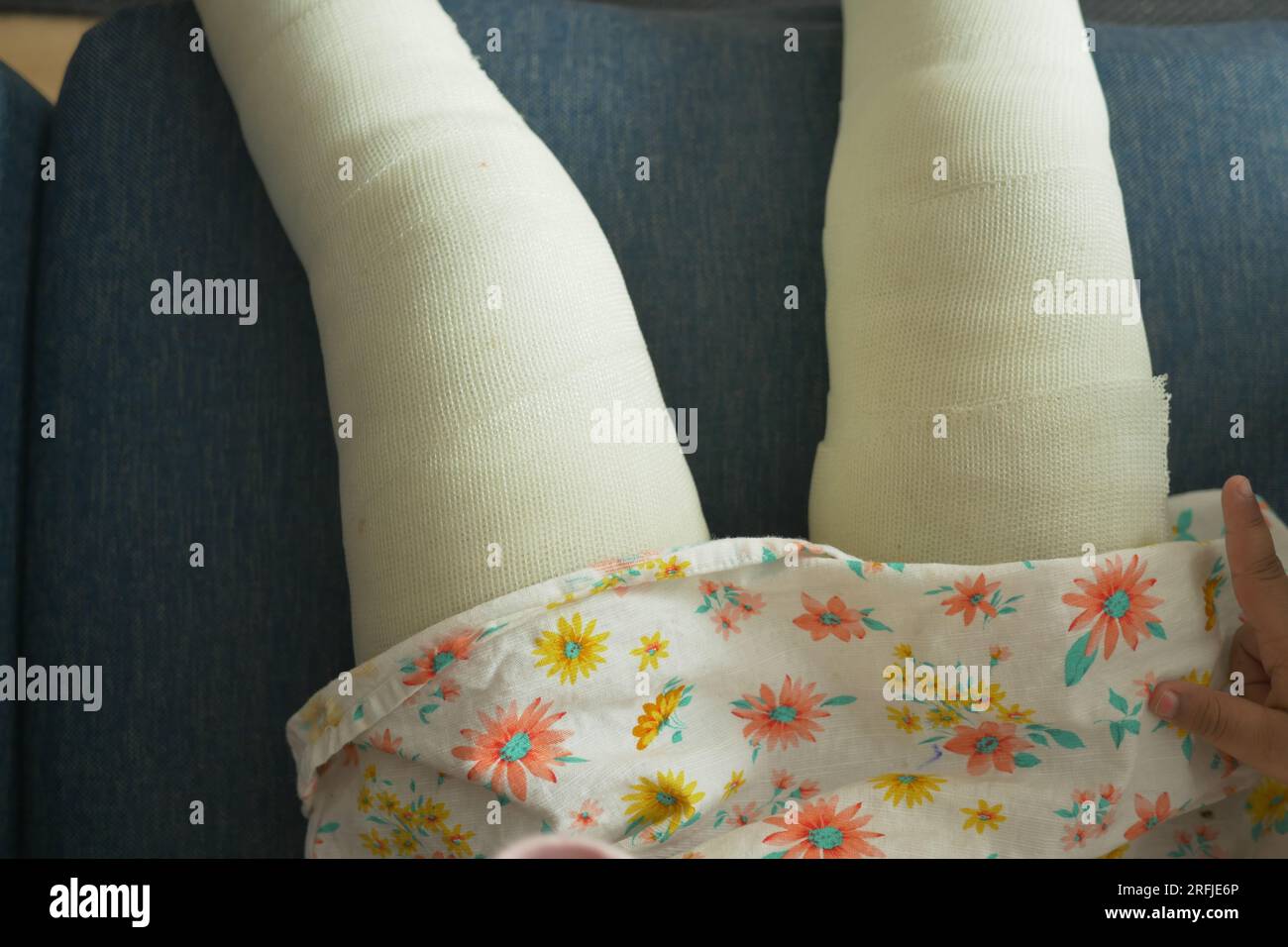 little child with plaster bandage on leg Stock Photo - Alamy