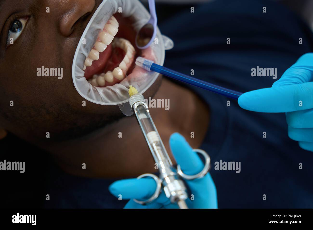 Close-up stomatologist making anaesthetic injection to gum around tooth ...