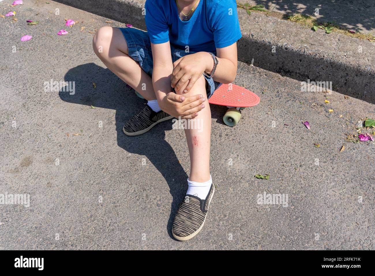 an abrasion on a child's leg from falling on an asphalt path while ...