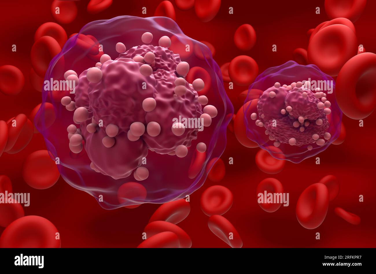 Leukemia Cancer Cells