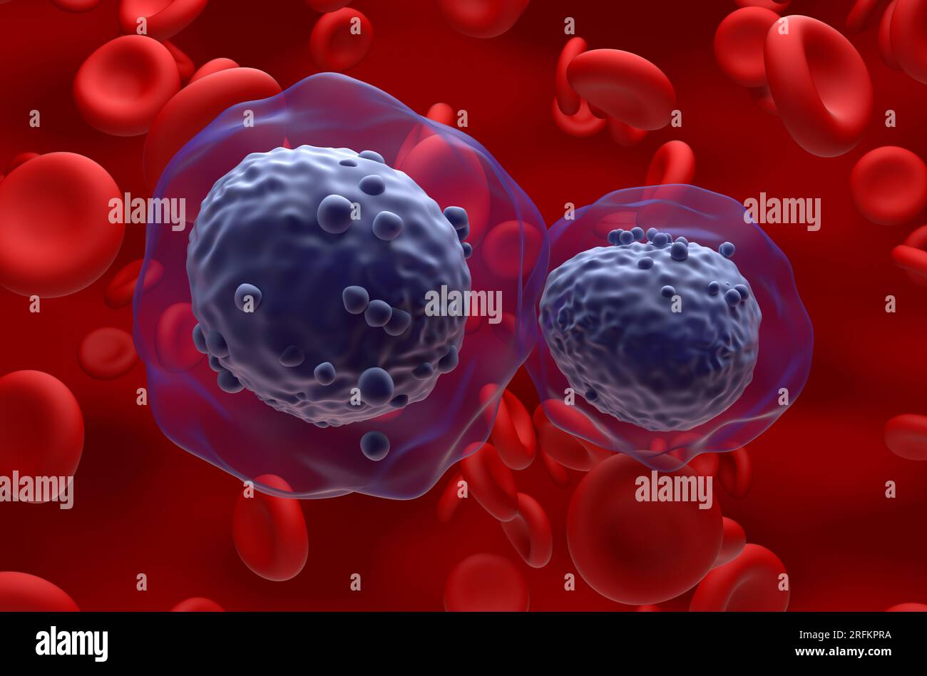 Acute myeloid leukemia (AML) cells in blood flow - closeup view 3d ...