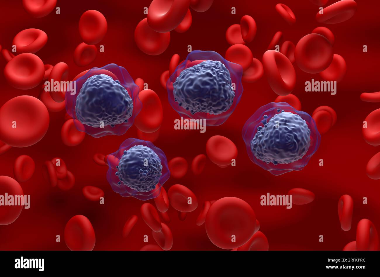 Acute myeloid leukemia (AML) cells in blood flow - isometric view 3d ...