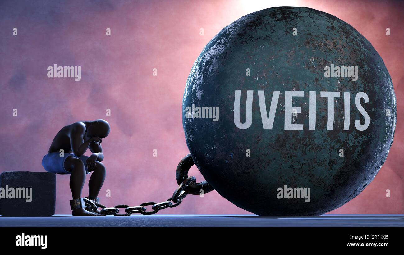 Uveitis - a metaphor showing human struggle with Uveitis. Resigned and ...