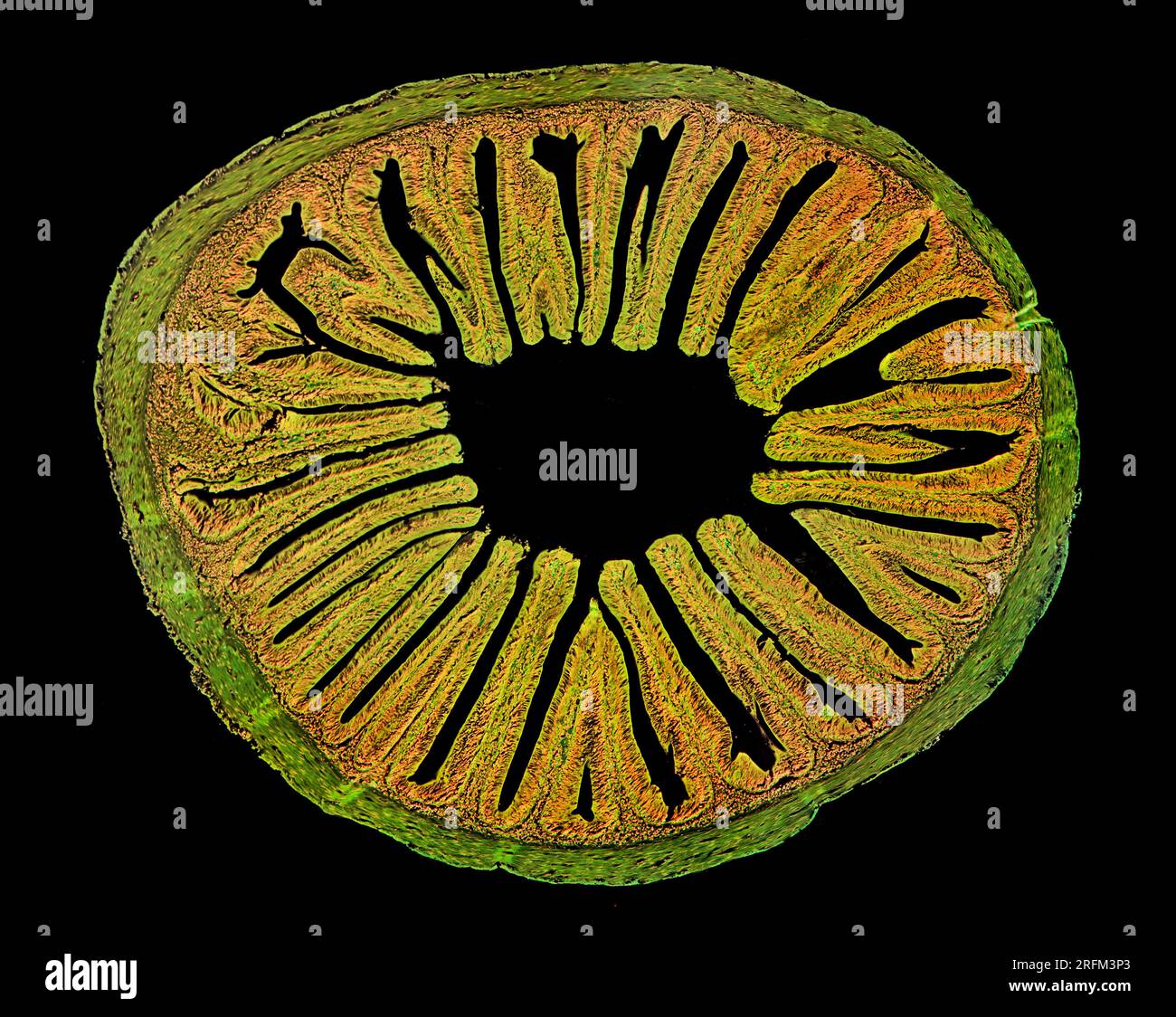 Goldfish small intestine TS. darkfield photomicrograph Stock Photo - Alamy