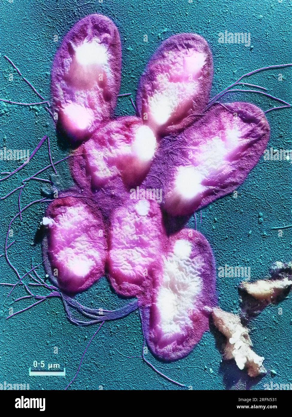 Transmission Electron Micrograph (TEM) shadowcast of rod bacterial ...