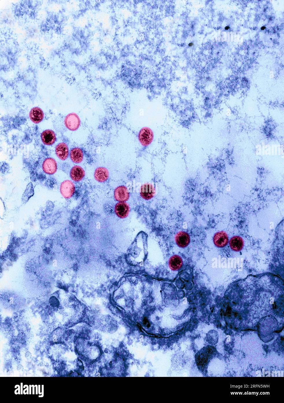 Transmission Electron Micrograph (TEM) revealing the presence of ...