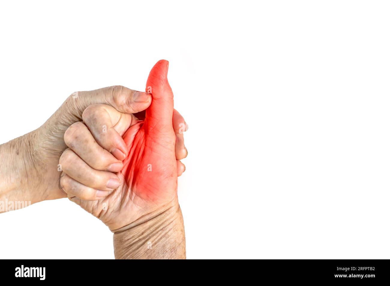 Painful thumb and thenar muscle of the elderly man. Isolated on white ...