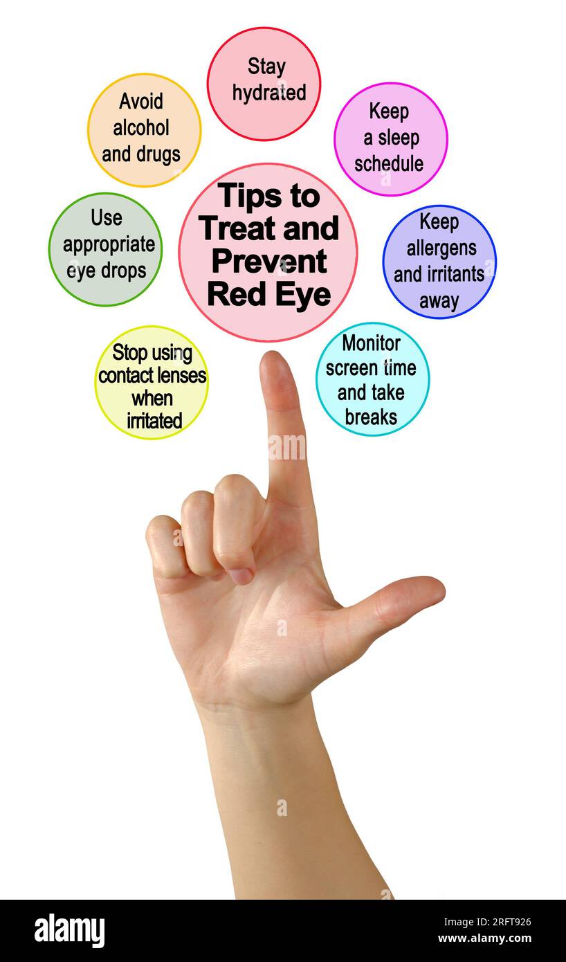 Tips to Treat and Prevent Red Eye Stock Photo - Alamy