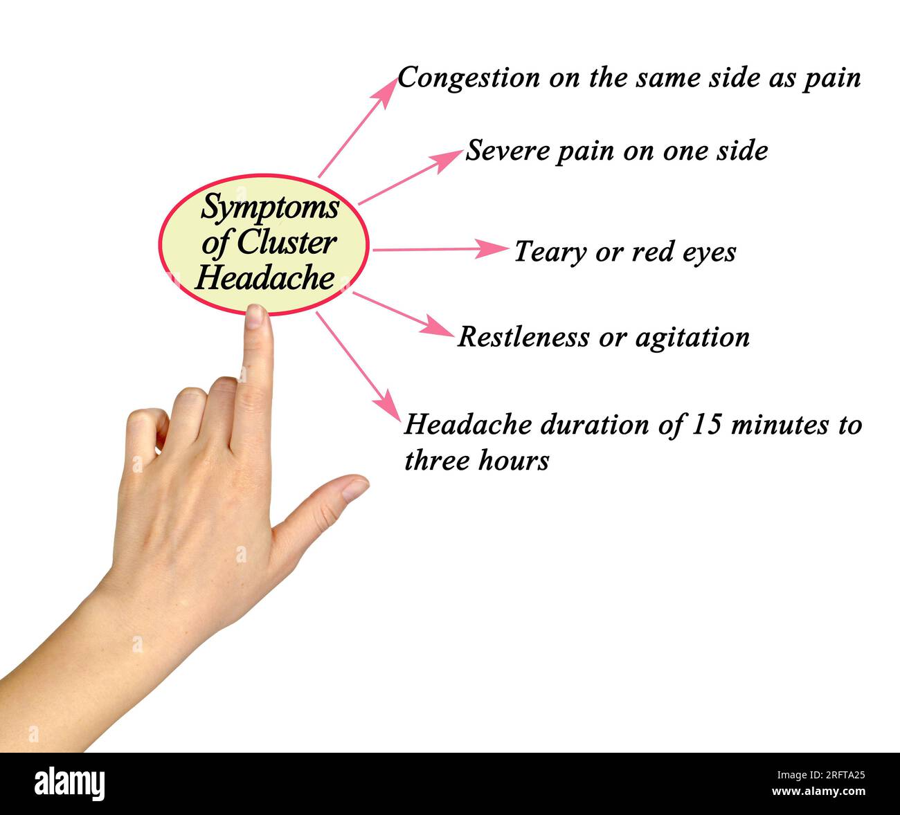 Five Symptoms of Cluster Headache Stock Photo - Alamy