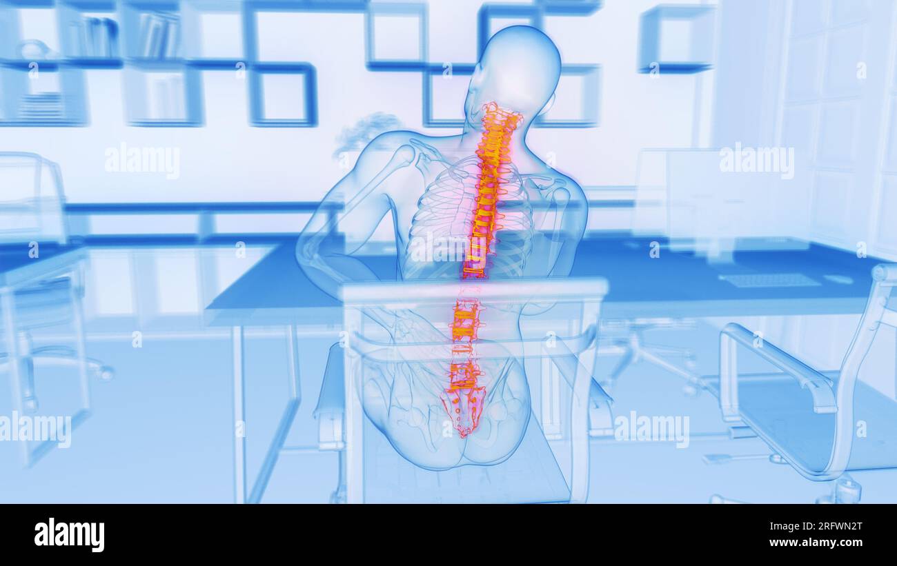 Back pain at work, illustration Stock Photo - Alamy