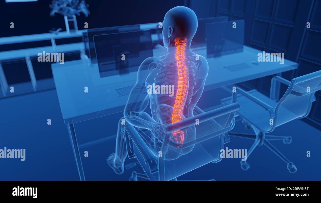 Back pain at work, illustration Stock Photo - Alamy