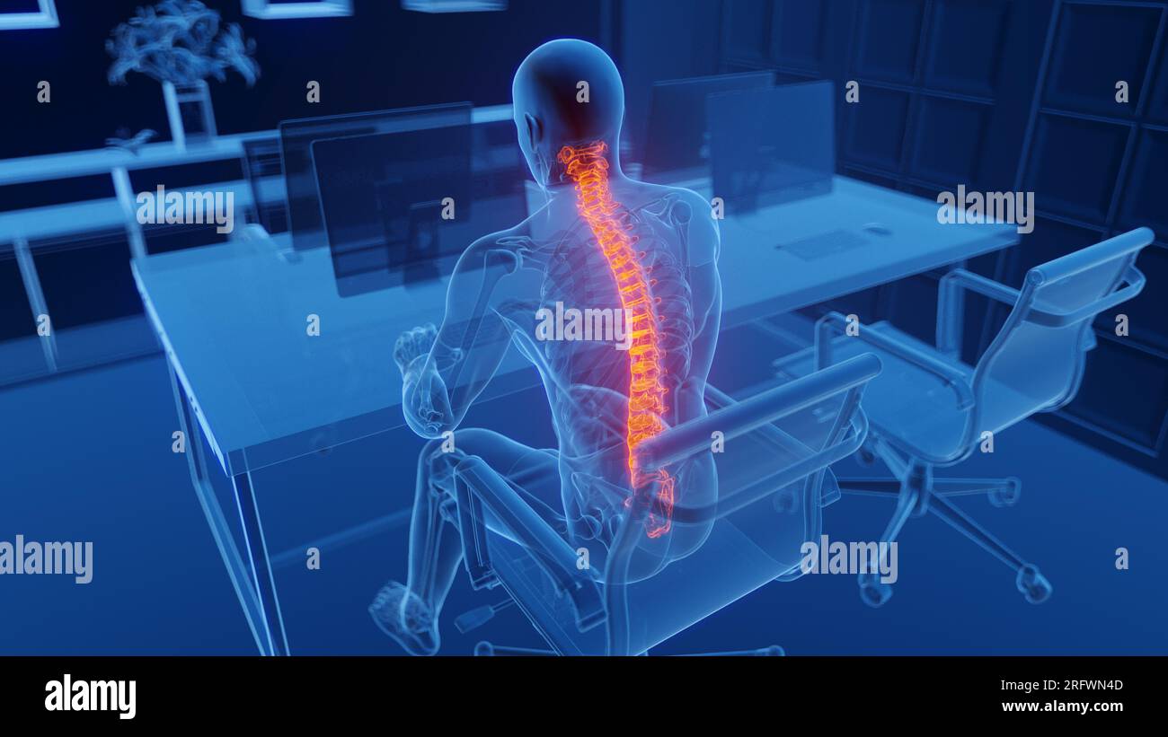 Back pain at work, illustration Stock Photo - Alamy