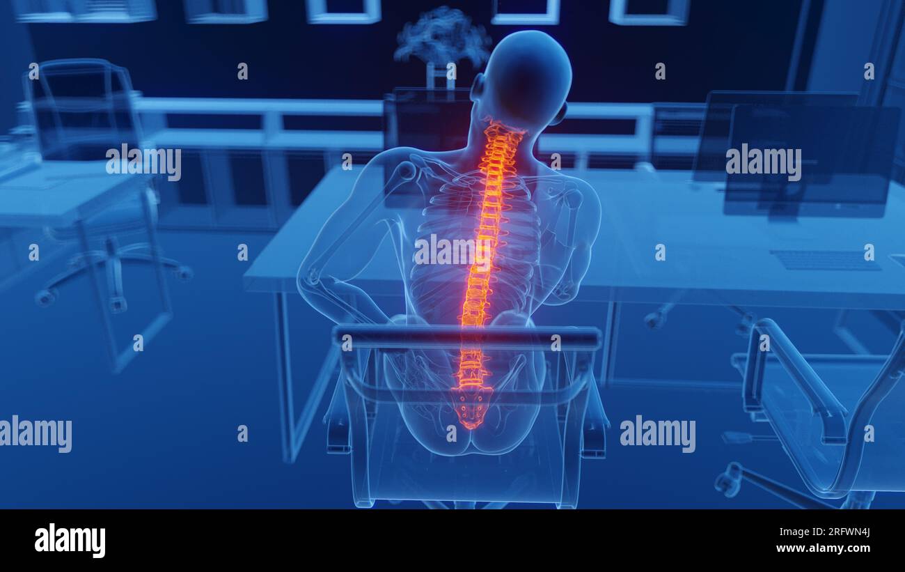 Back pain at work, illustration Stock Photo - Alamy