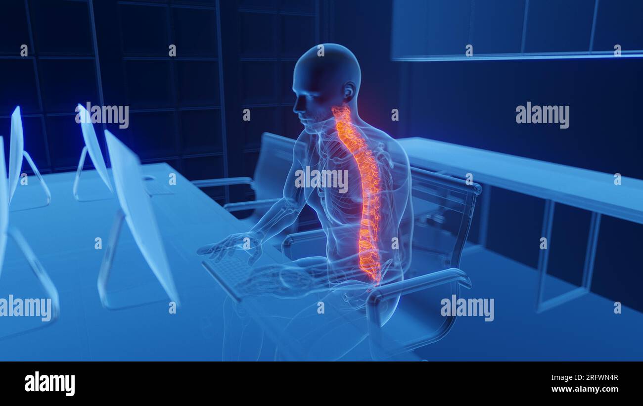 Back pain at work, illustration Stock Photo - Alamy