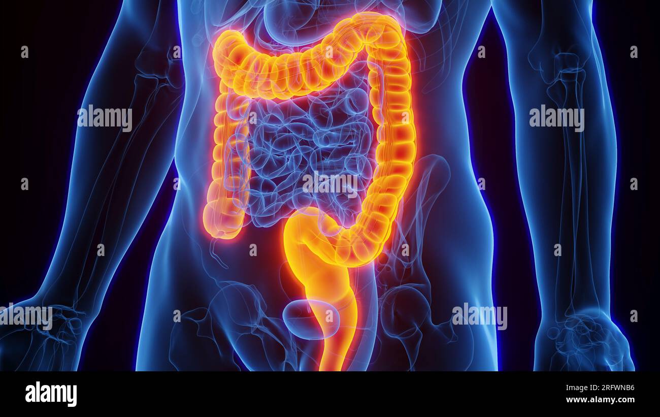 Left colon hi-res stock photography and images - Alamy