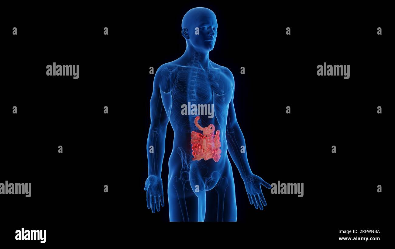 Inflamed small intestine hi-res stock photography and images - Alamy