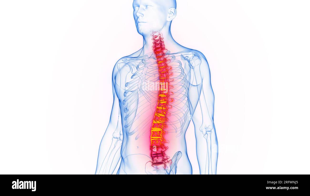Inflamed spinal joint hi-res stock photography and images - Alamy