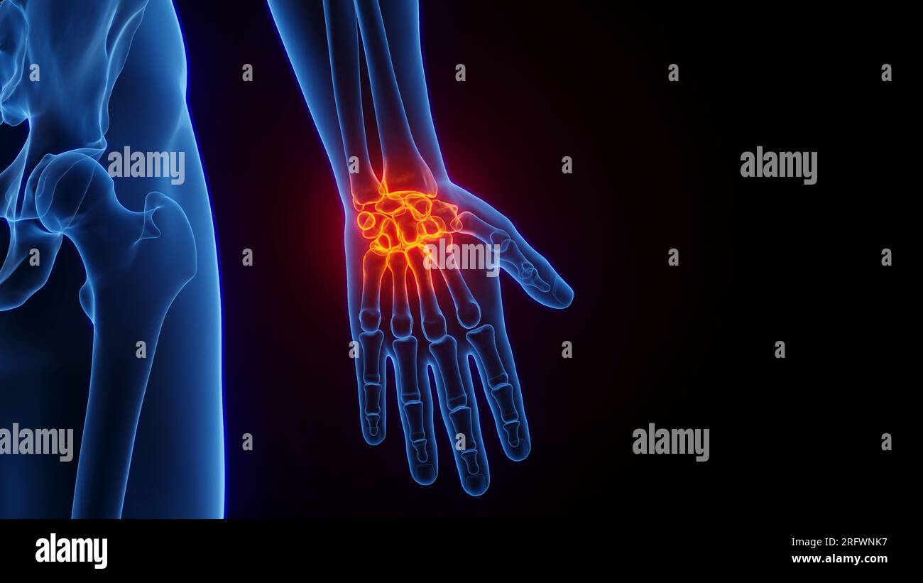Internal wrist hi-res stock photography and images - Alamy