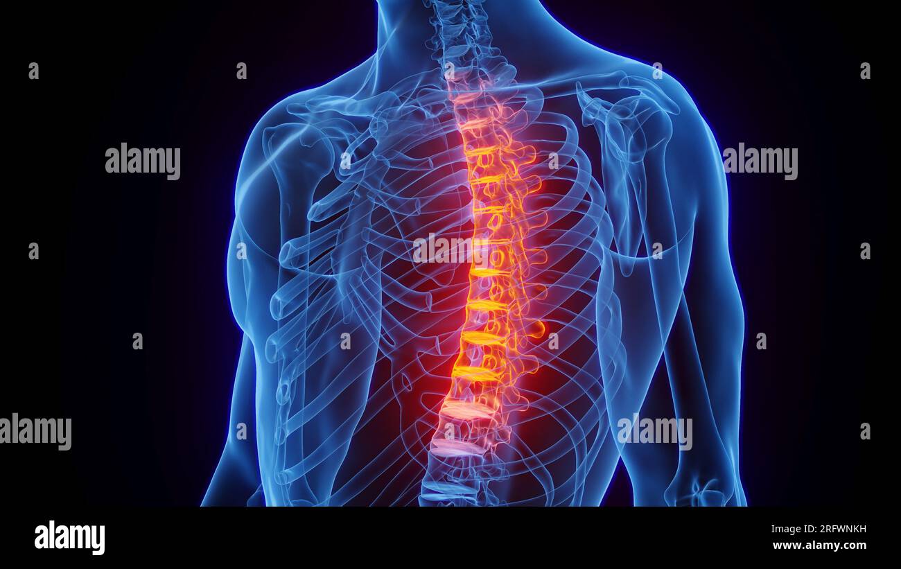 Spondyloarthritis illustration hi-res stock photography and images - Alamy