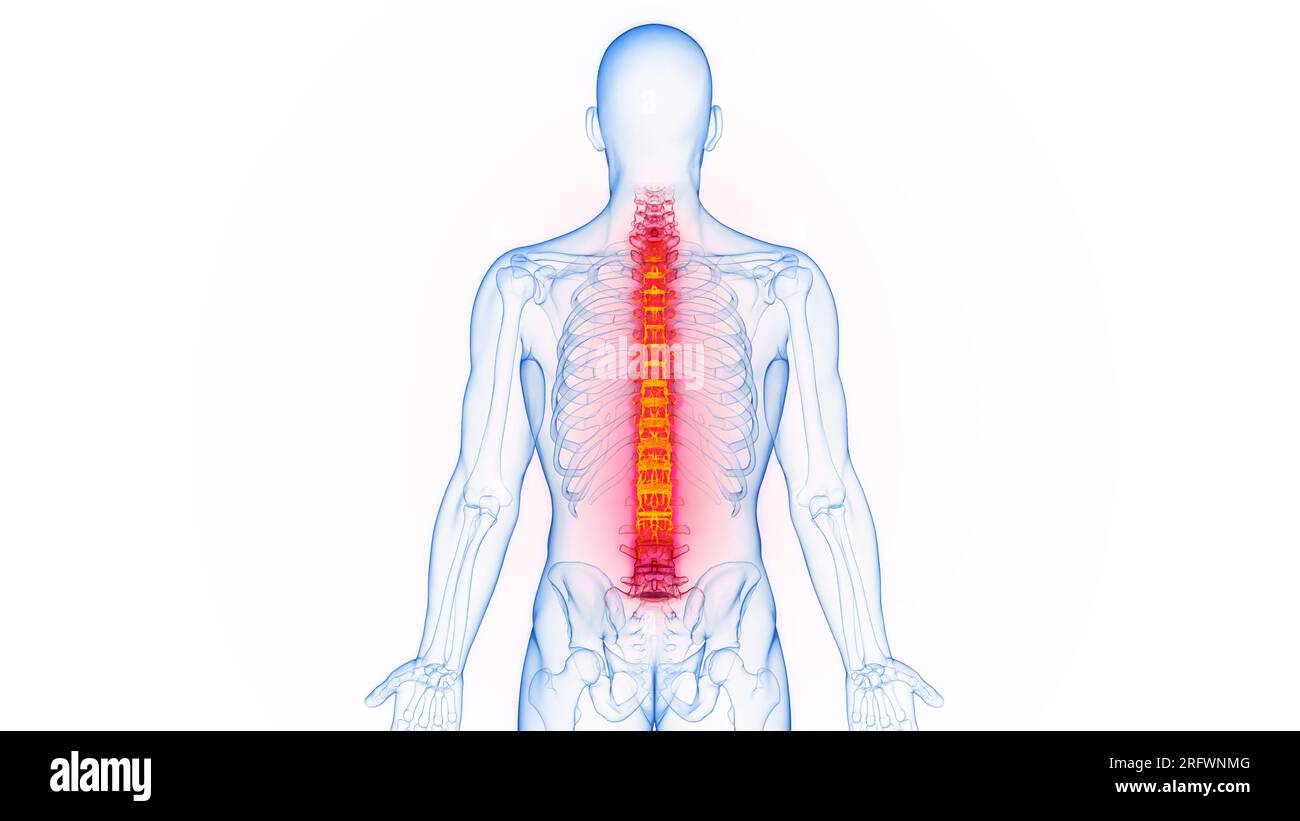 Inflamed spinal joints hi-res stock photography and images - Alamy