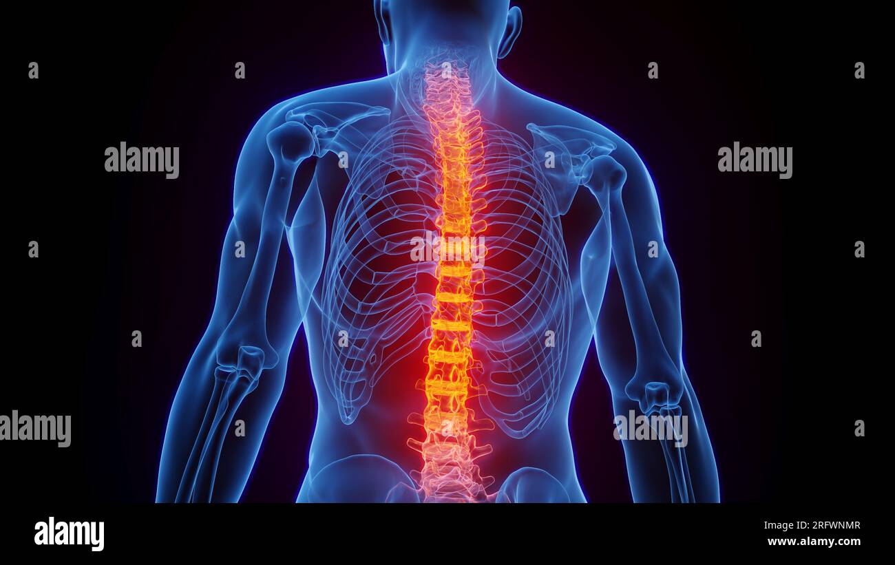 Spondyloarthritis illustration hi-res stock photography and images - Alamy