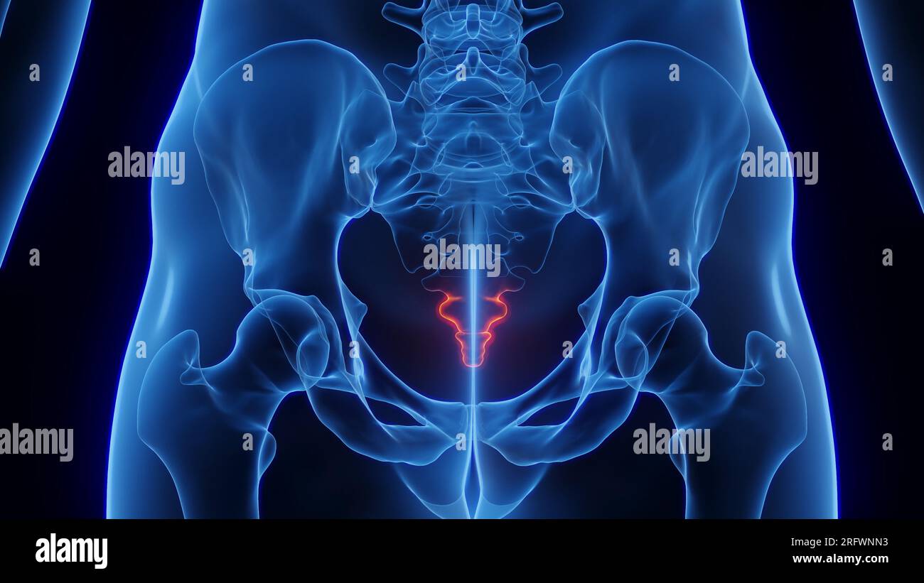 Inflamed coccyx hi-res stock photography and images - Alamy