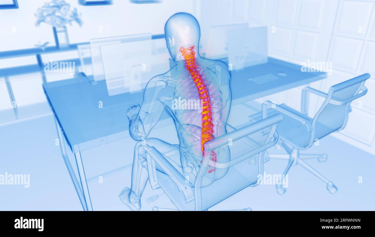 Back pain at work, illustration Stock Photo - Alamy