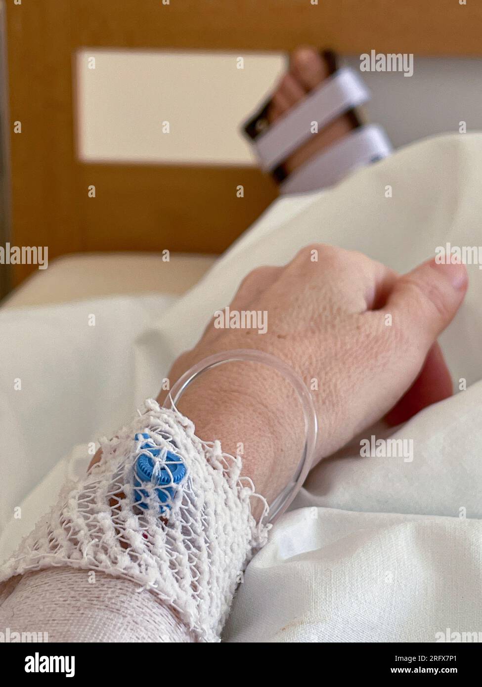 Caucasian woman lying in hospital with broken leg. IV solution drip on ...