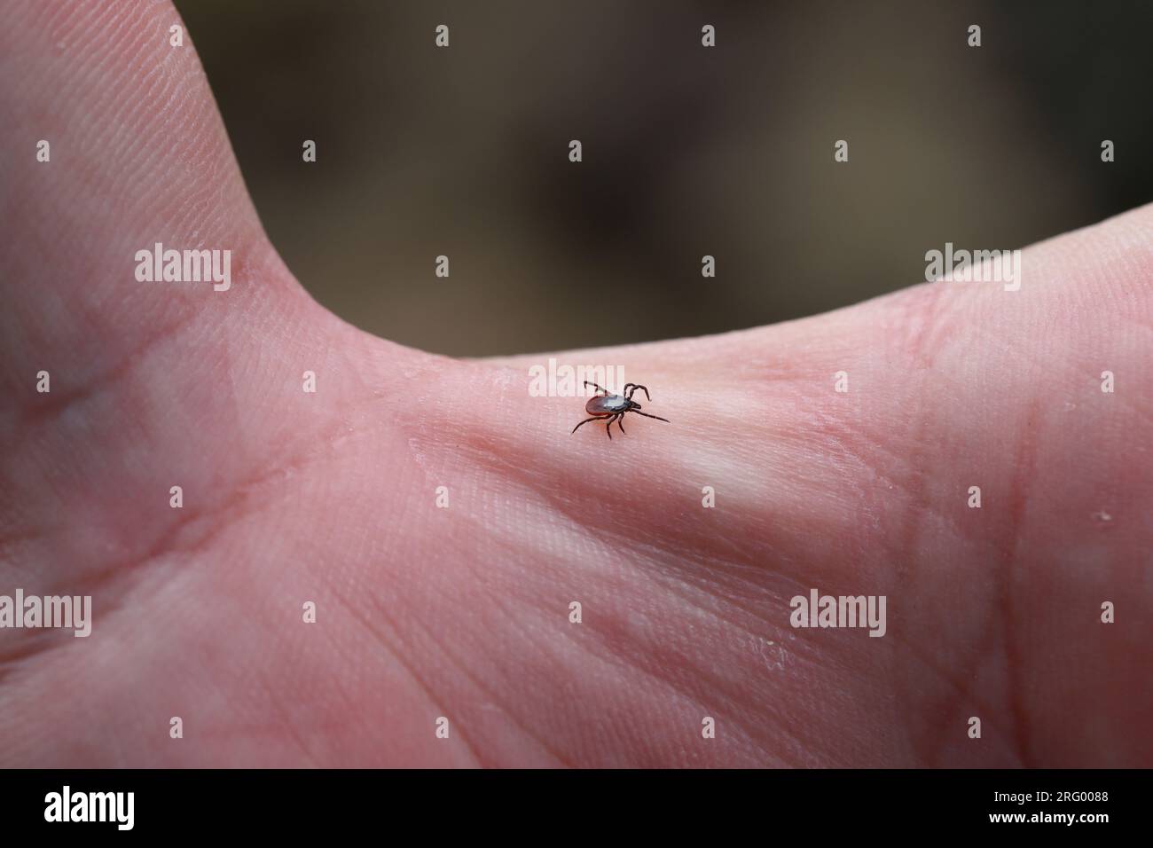 A tick walking on the hand. It is a dangerous arachnid that is a vector ...