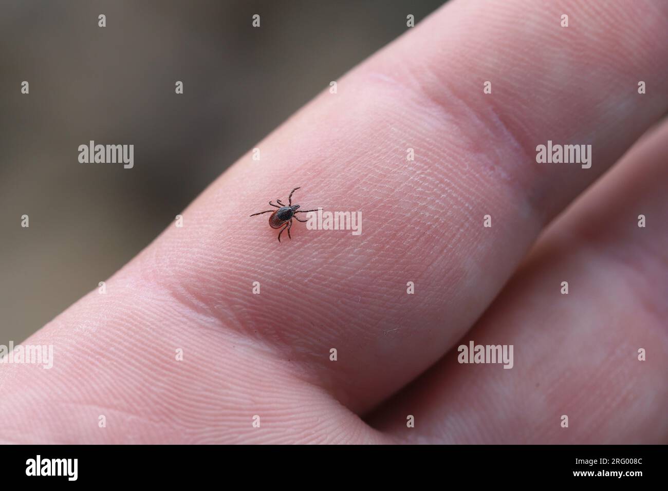 A tick walking on the hand. It is a dangerous arachnid that is a vector ...