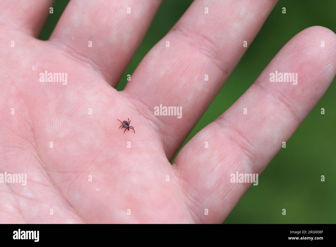 A tick walking on the hand. It is a dangerous arachnid that is a vector ...