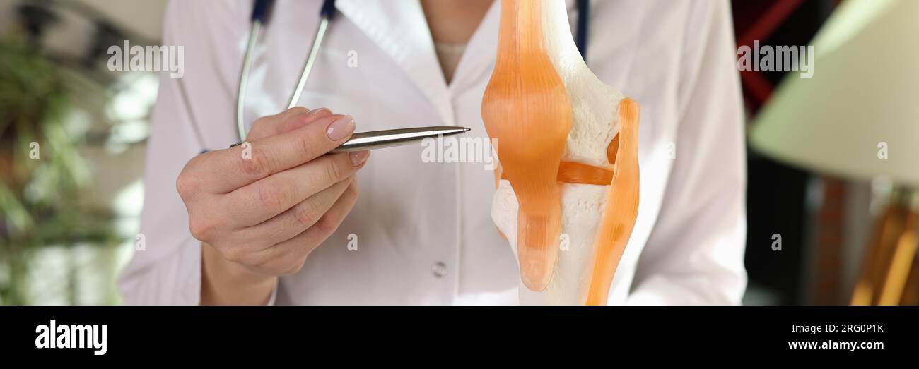 Rheumatologist points anatomical model hi-res stock photography and ...