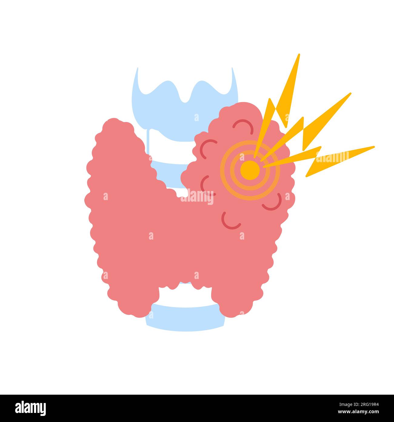 Thyroid gland with goiter body organ icon Stock Vector Image & Art - Alamy