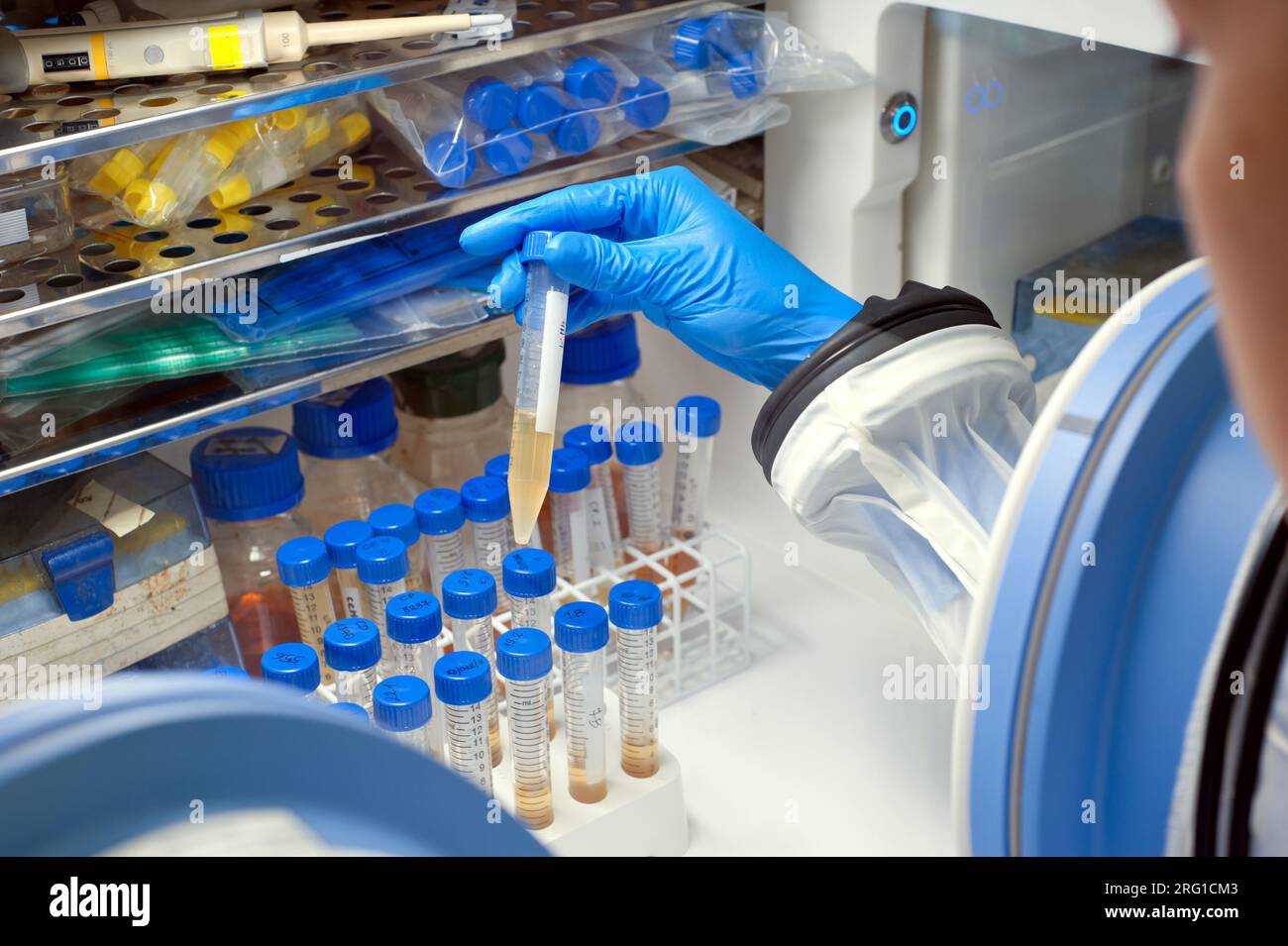 Bacterial culture tubes hi-res stock photography and images - Alamy
