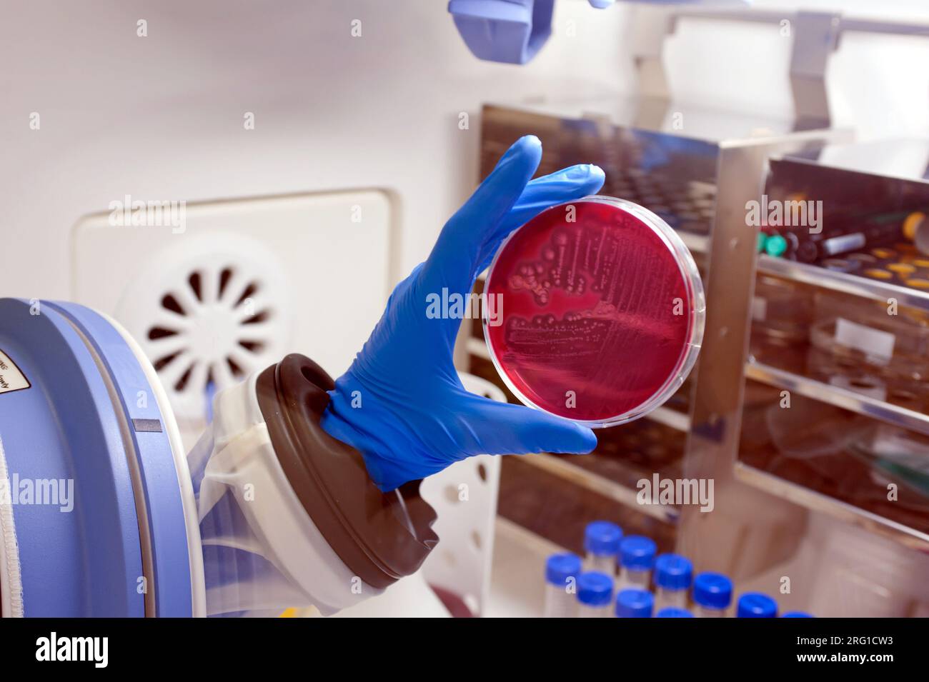 Bacterial culture plate holding in hand hi-res stock photography and ...