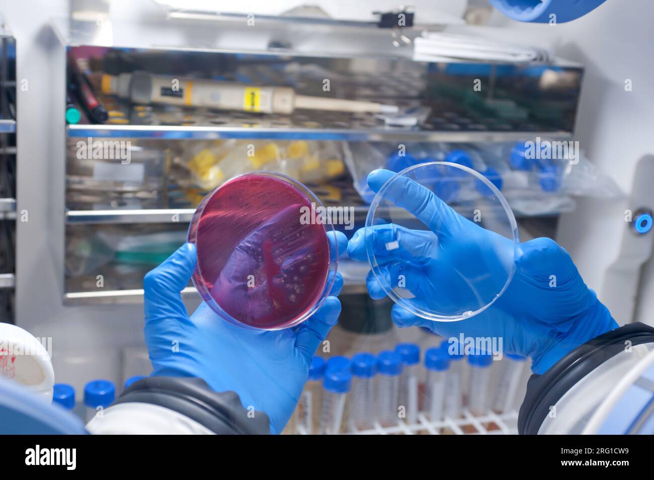 Bacterial culture tubes hi-res stock photography and images - Alamy