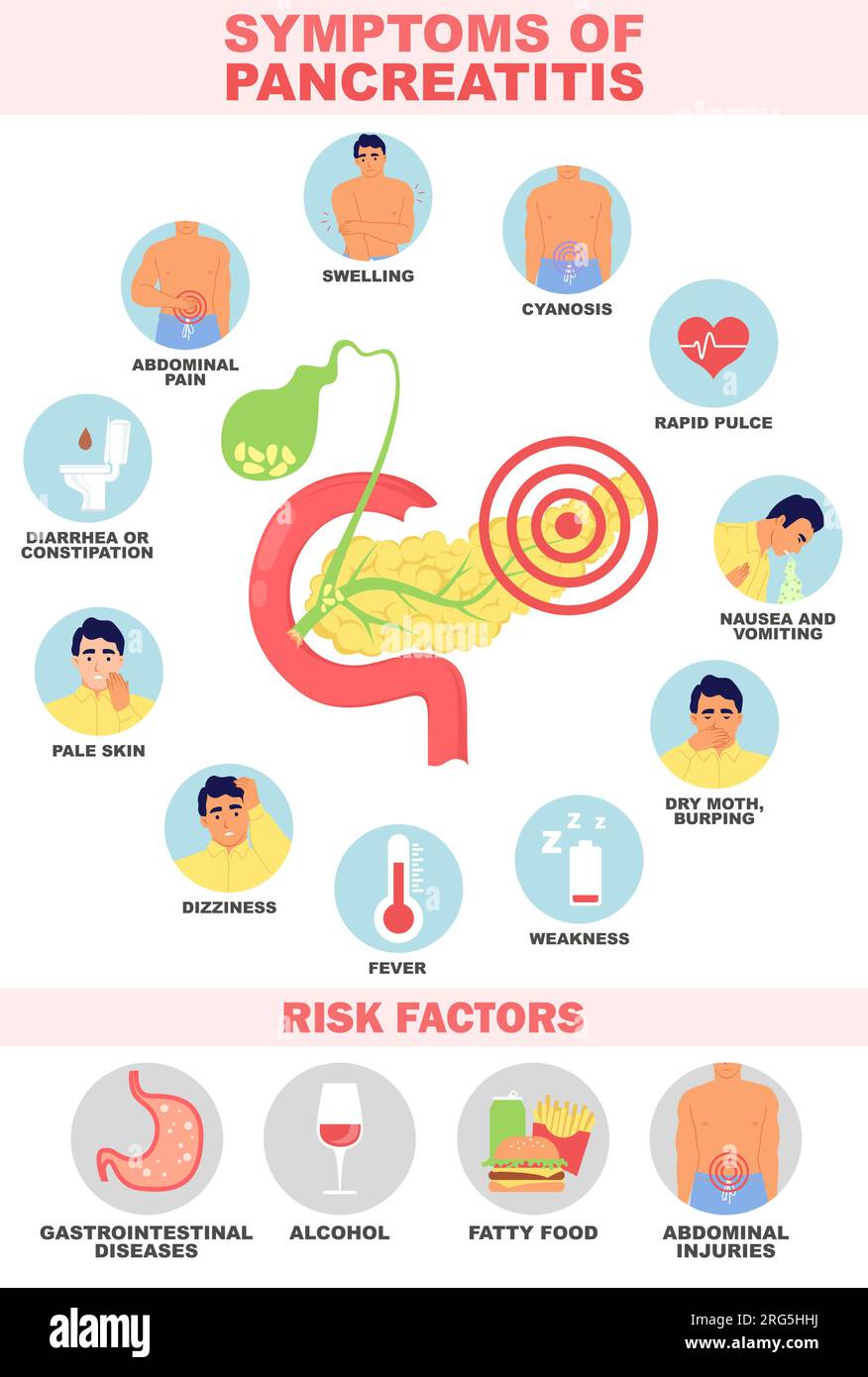 Symptom and risk factors of pancreatitis vector illustration Stock ...