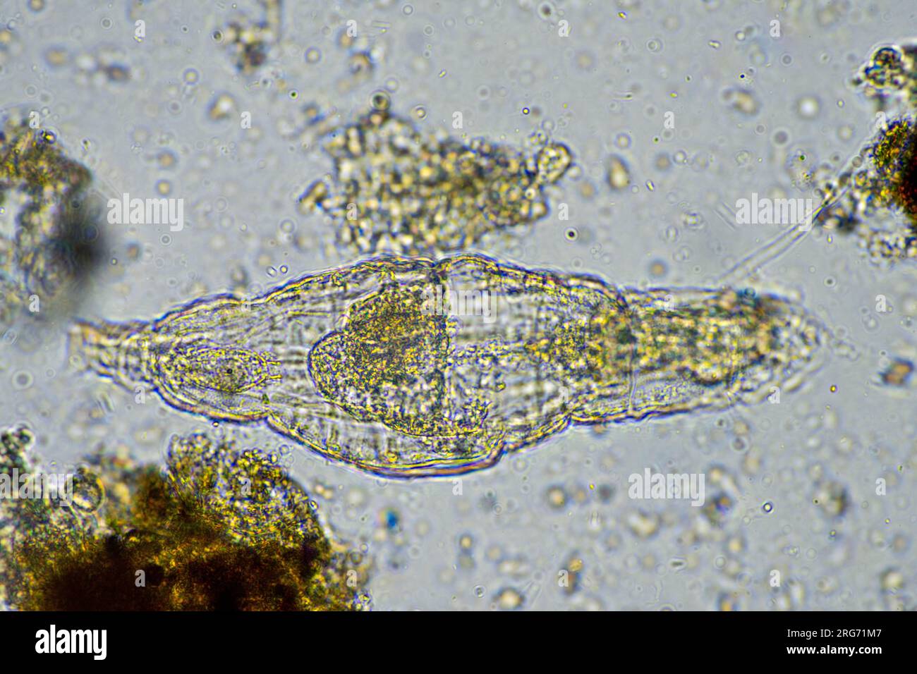Rotifer hi-res stock photography and images - Alamy