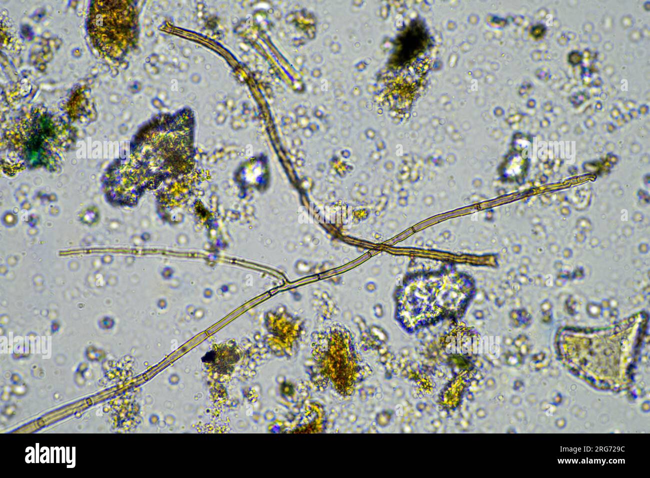 fungal hyphae on a soil sample on a farm. fungi storing carbon in the ...