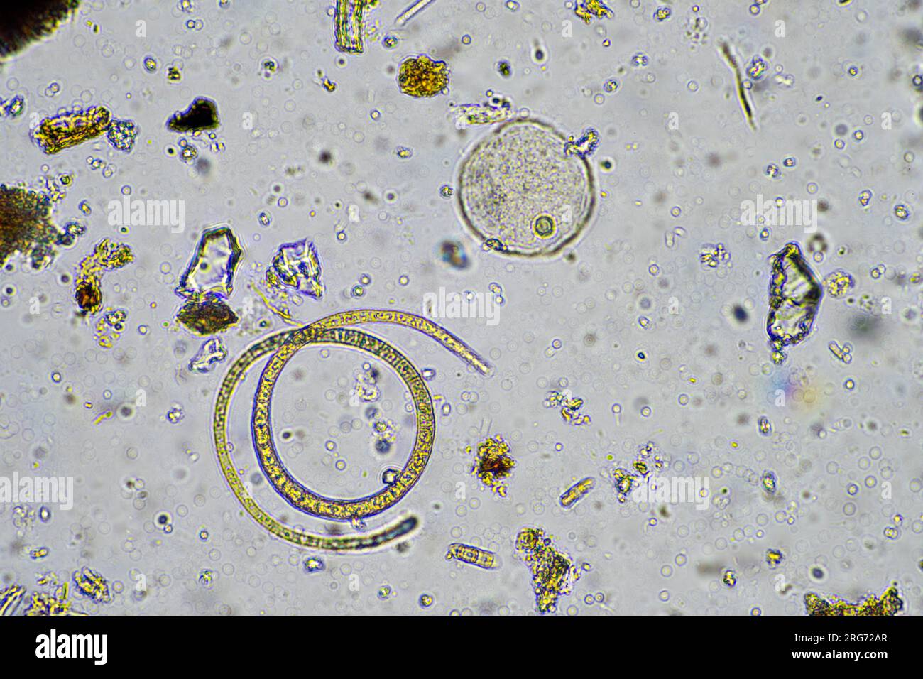 living soil life in a soil sample under the microscope in a lab Stock ...